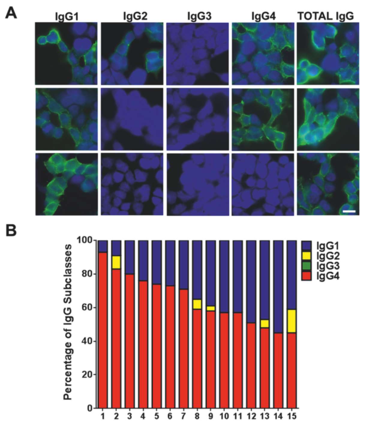 抗IgLON5脑病 - 海默医学