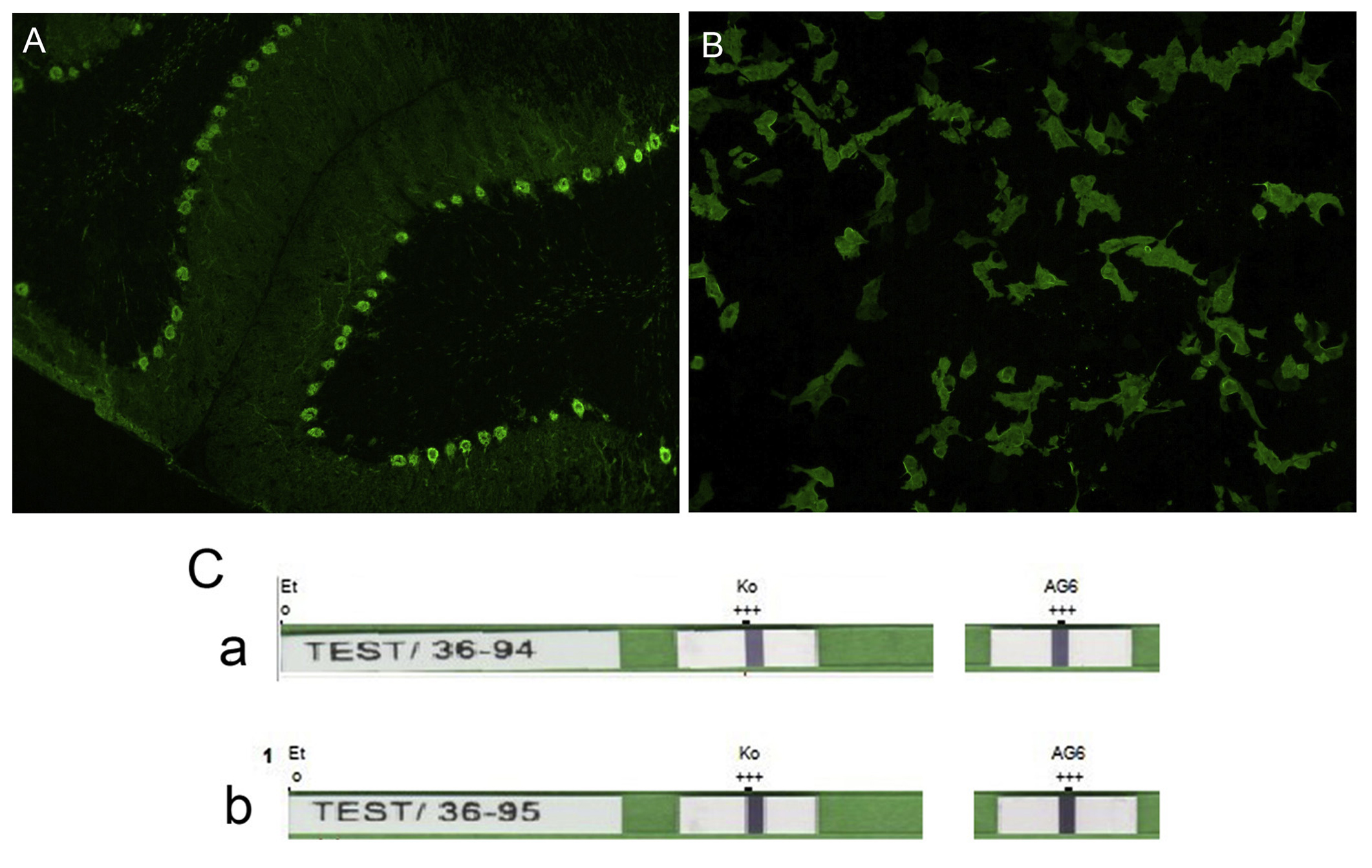 珠联璧合——TBA与其他特异性检测方法联合 - 海默医学