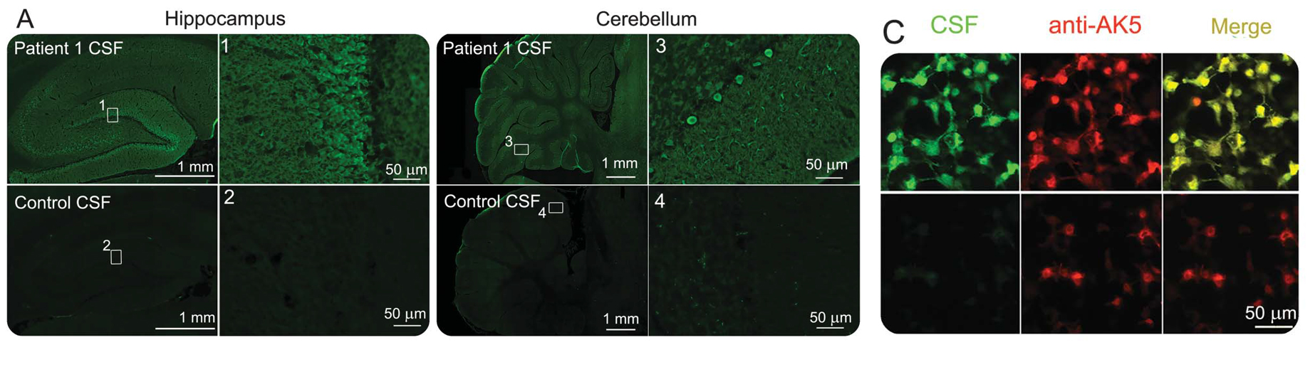 浅谈AK5-LE - 海默医学