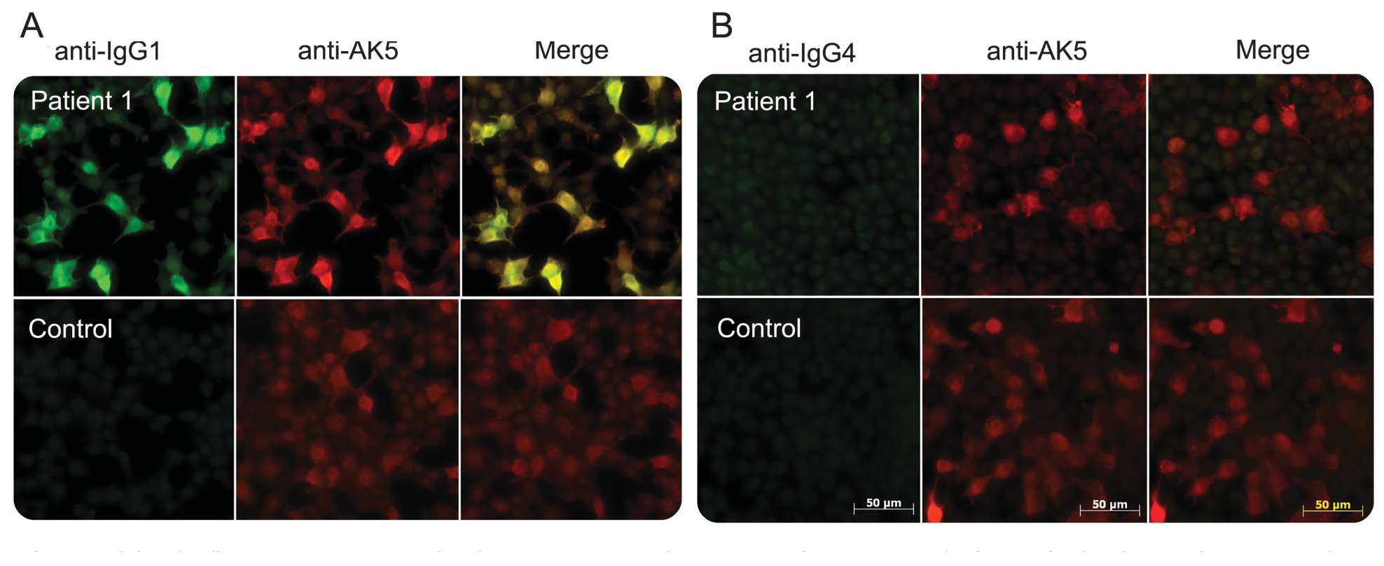 浅谈AK5-LE - 海默医学